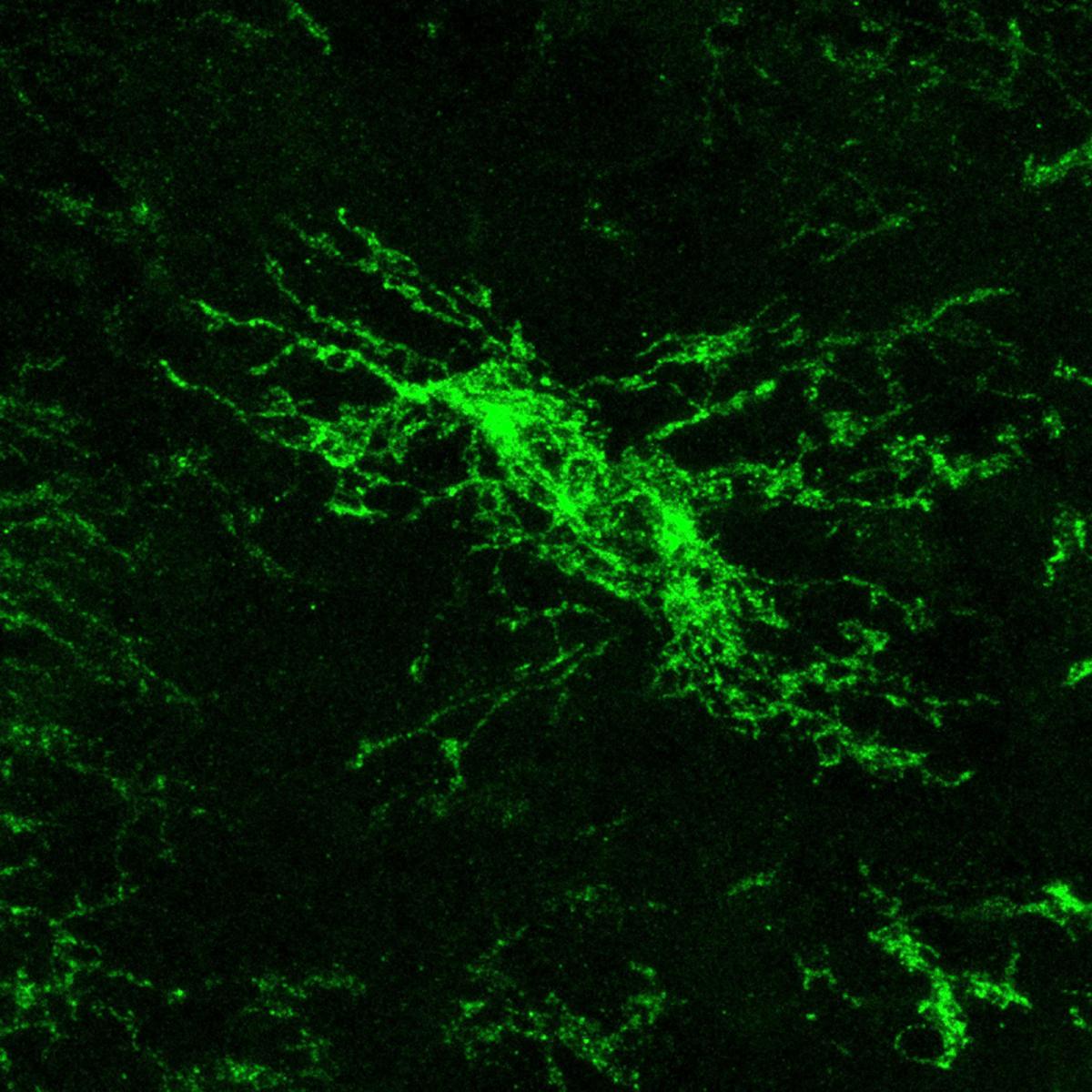 Surprising finding links sleep, brain insulation, and neurodegeneration ...