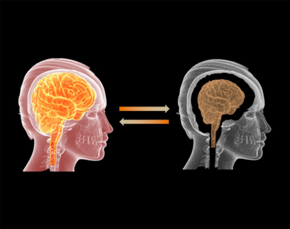 Stanford Brain Rejuvenation Project (Phase 2) | Knight Initiative